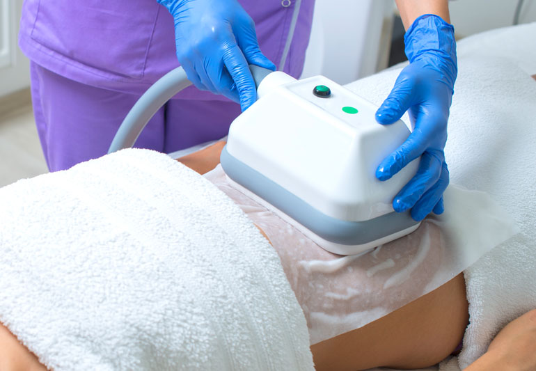 Fat Freezing: Revolutionizing Fat Loss Treatments - The Clinic Room ...