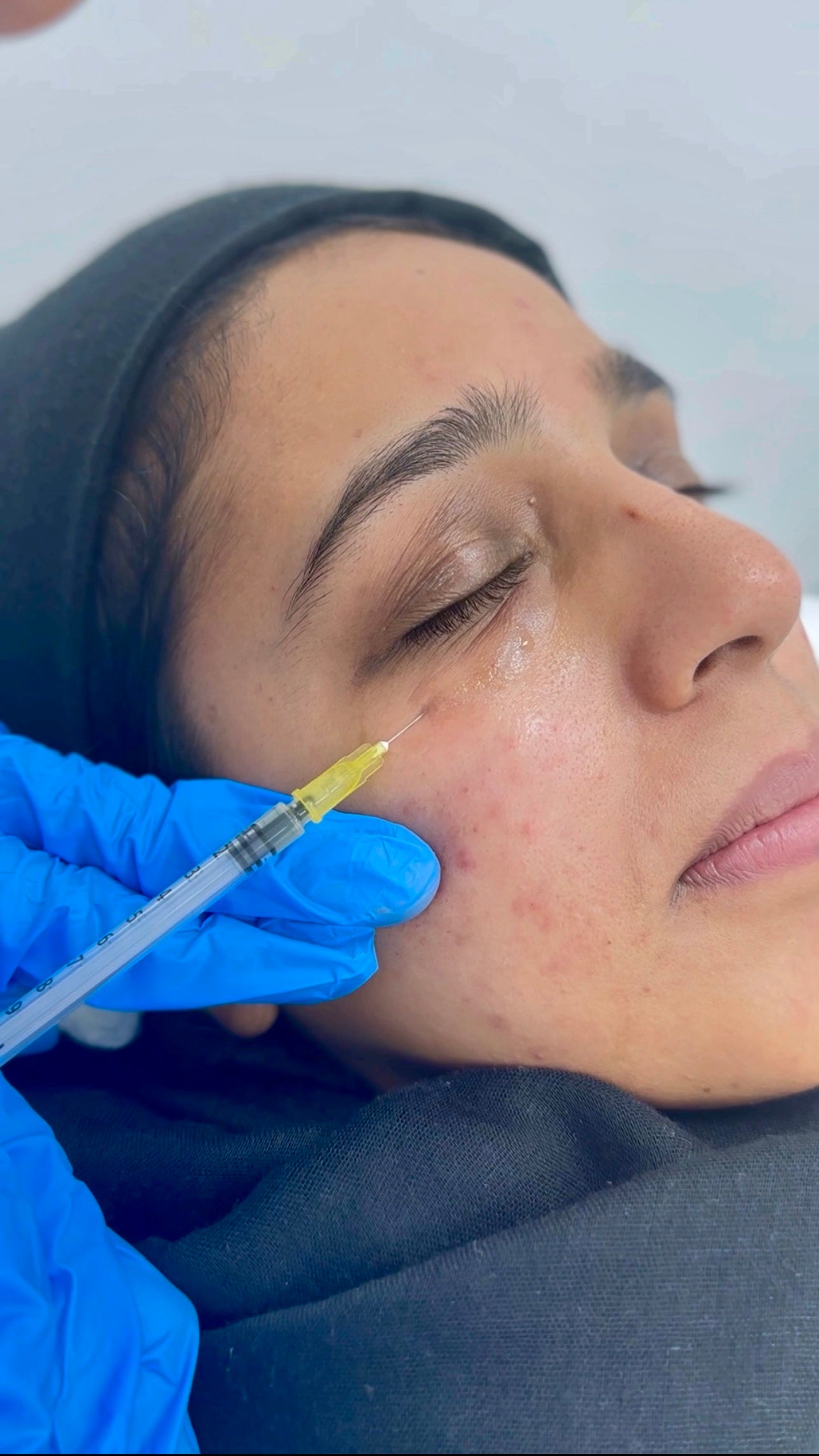 Lumi Eyes | Treatments - The Clinic Room – theclinicroom